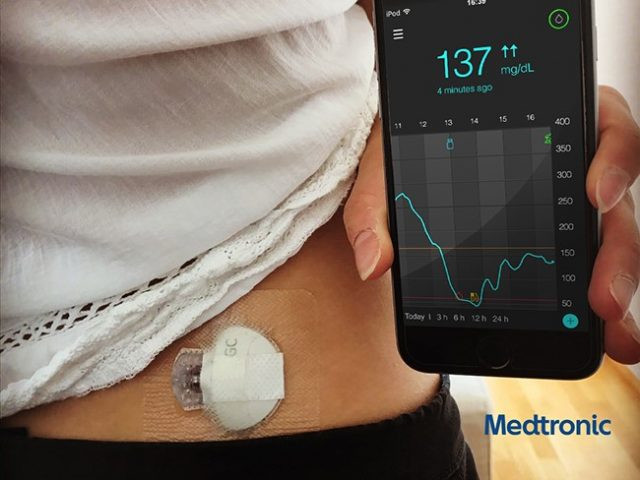 Medtronic Guardian Connect CGM Transmitter System Price in Pakistan ...